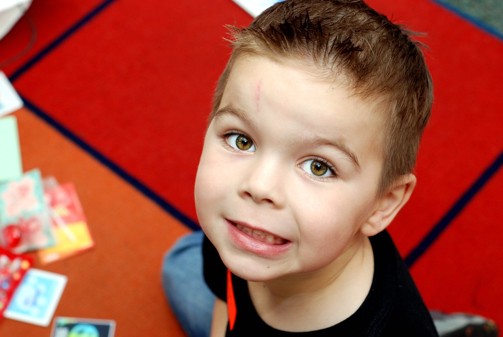 Understanding and Managing Oppositional Defiant Disorder (ODD) in ...